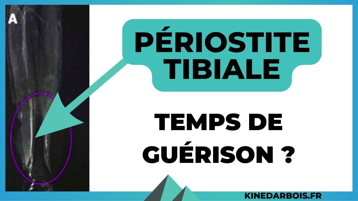 Périostite tibiale : à quelle durée de guérison s'attendre