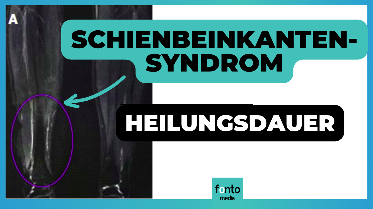 Schienbeinkantensyndrom : Dauer? (+ Was tun ?)