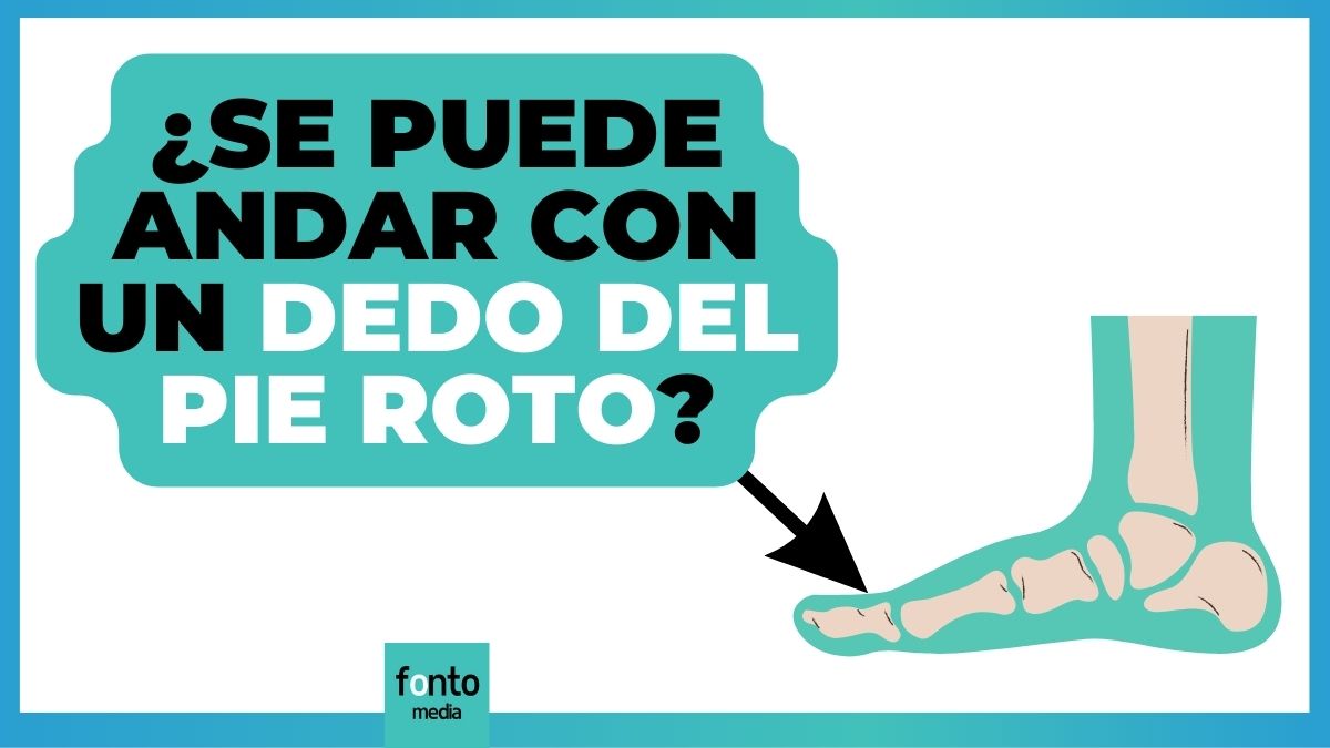 ¿Se puede andar con un dedo del pie roto? (+ Consejos)
