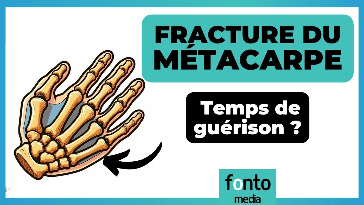 Quel temps de guérison d'une fracture du métacarpe à la main