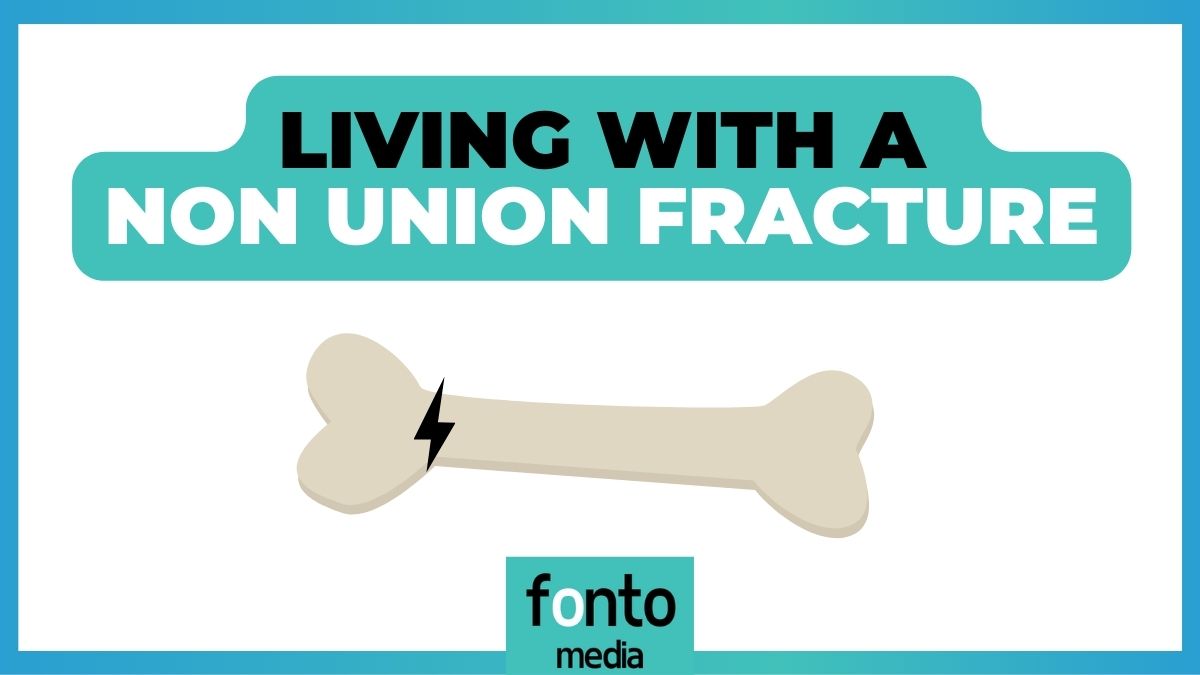 Living With a Nonunion Fracture: A guide to reassure you