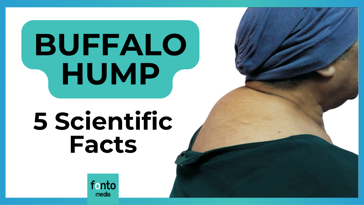 5 Scientific Facts Decoded About the Buffalo Hump