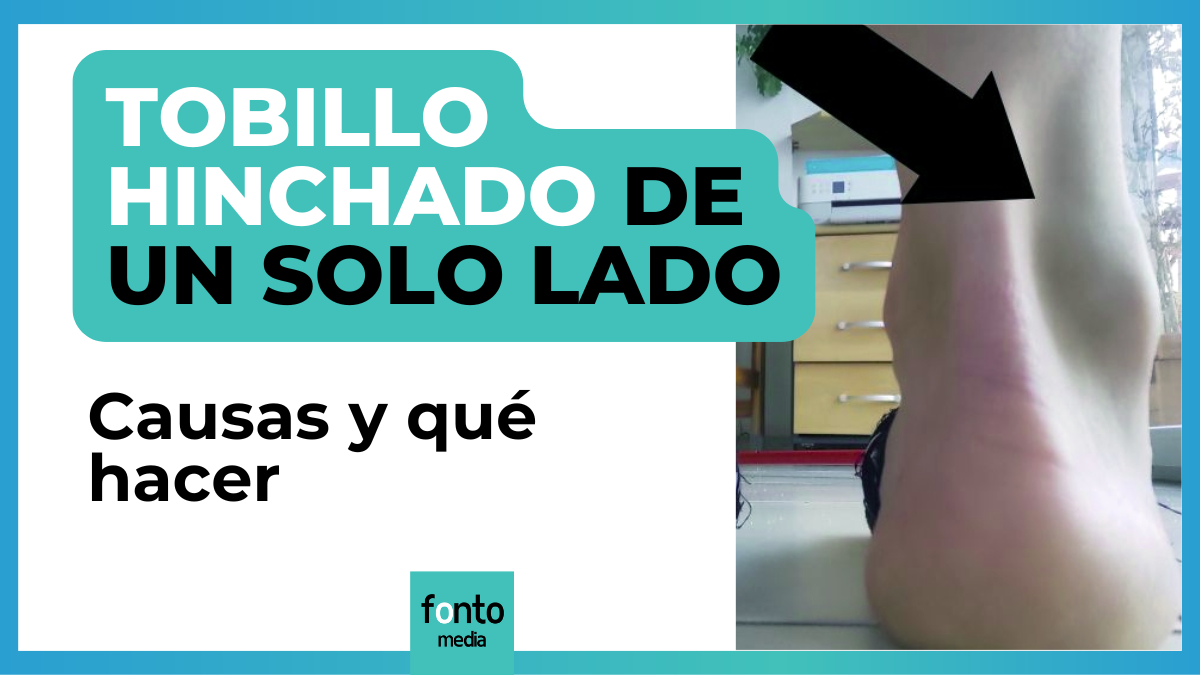 Un solo tobillo hinchado: ¿causa y qué hacer?