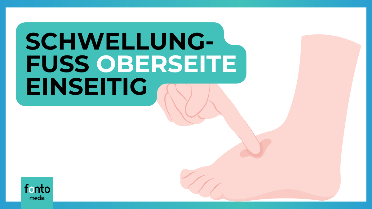 Schwellung Fuß Oberseite einseitig : Warum und was ist zu tun?