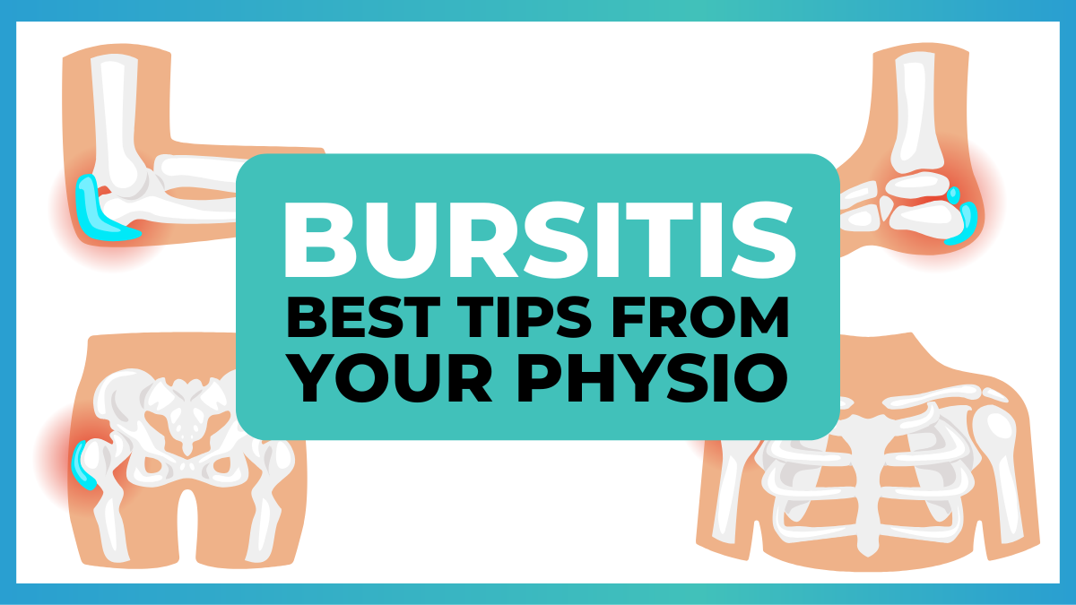 Bursitis (Hygroma): a Physiotherapist's Complete Guide