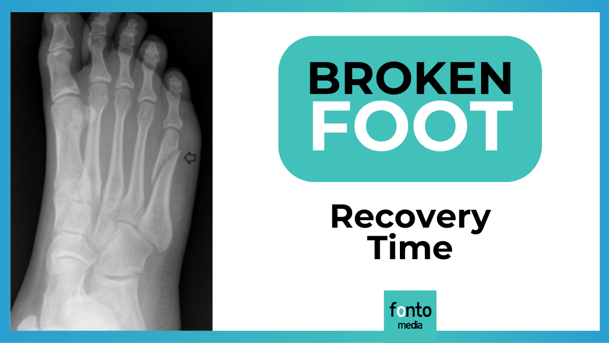 Broken foot: healing time, rehabilitation: physiotherapy advice